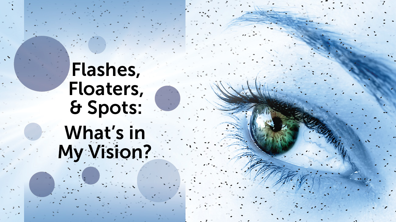 Do You See Spots In Your Vision What Is Normal And What Is Not 